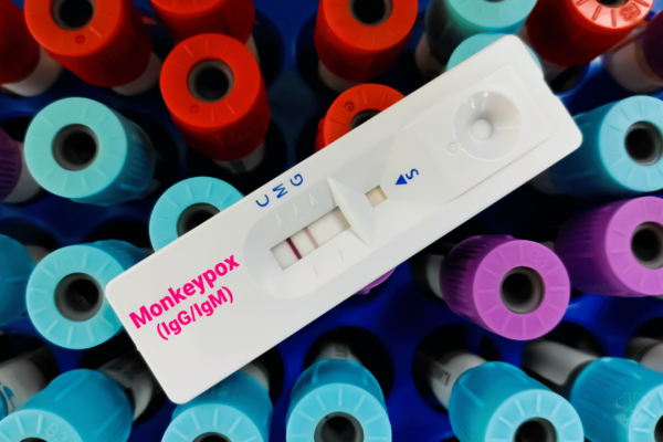Brucella sp, rosa bengala – Laboratorios QCV